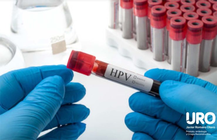 Virus del Papiloma Humano (VPH) y cáncer | Dr. J. Romero